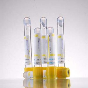 SST Serum Separation Tubes - Yongkang Medical